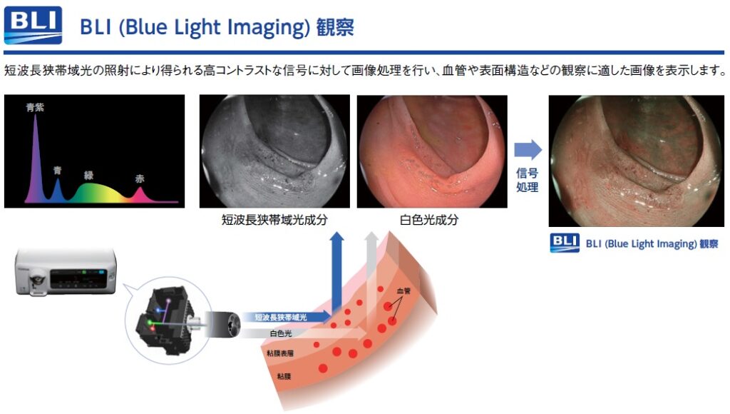 内視鏡画像診断支援システム CAD EYE™（キャドアイ) を導入しました | トリイクリニック 蒲郡市